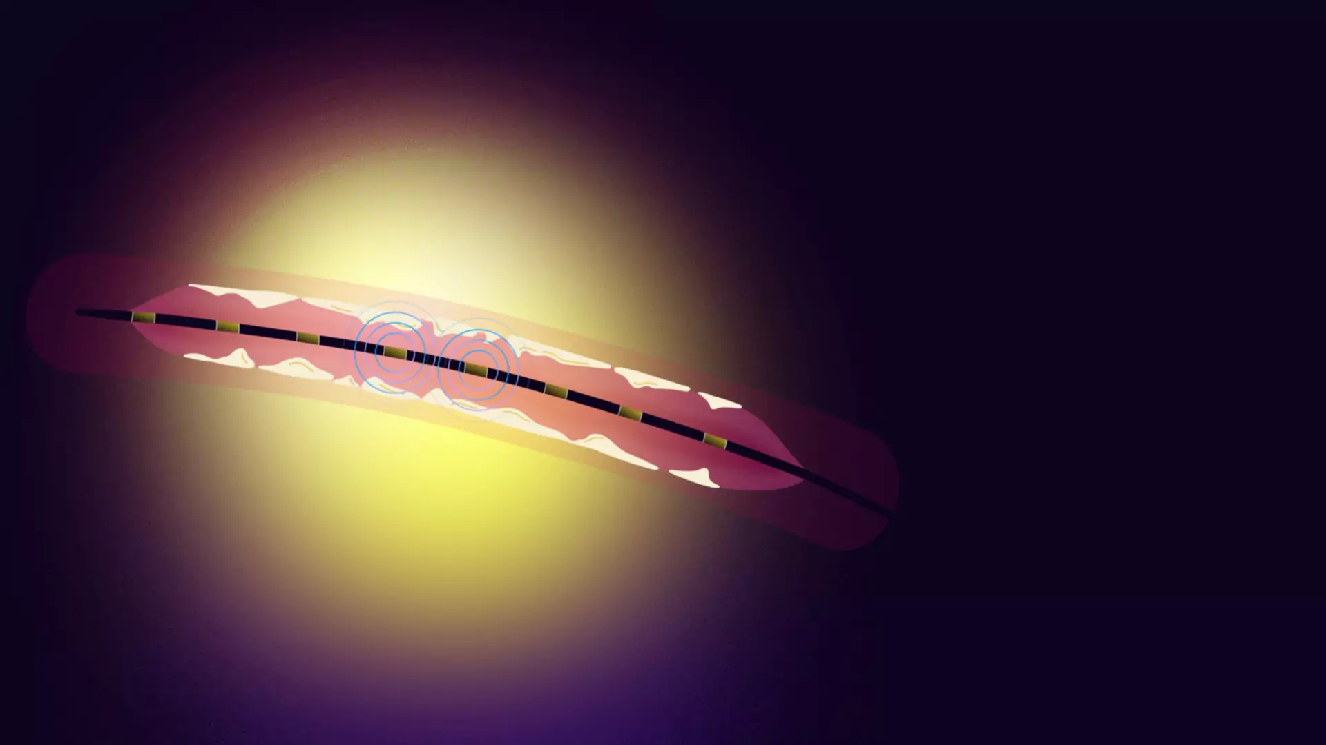 Beats Of Change - The joy of walking freely - World Heart Federation