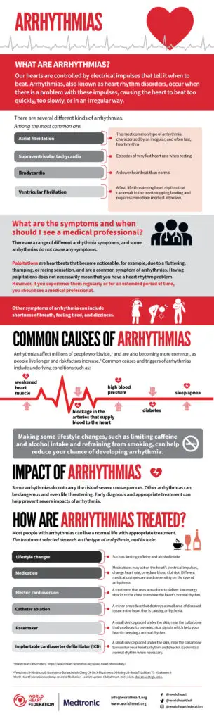 ARRHYTHMIAS ANIMATION - World Heart Federation